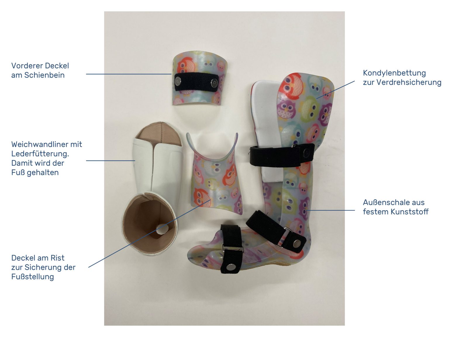 Angeborener Klumpfuß – Fuchs Orthopädietechnik